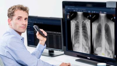 Chest X-Ray AI visualization: Innovation powered by RUBEE™ for AI