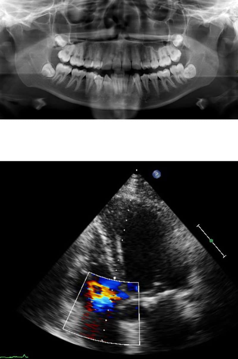 XERO Xtend - Full Fidelity - AGFA HealthCare