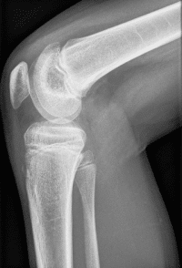 XERO Xtend - Full Fidelity - AGFA HealthCare