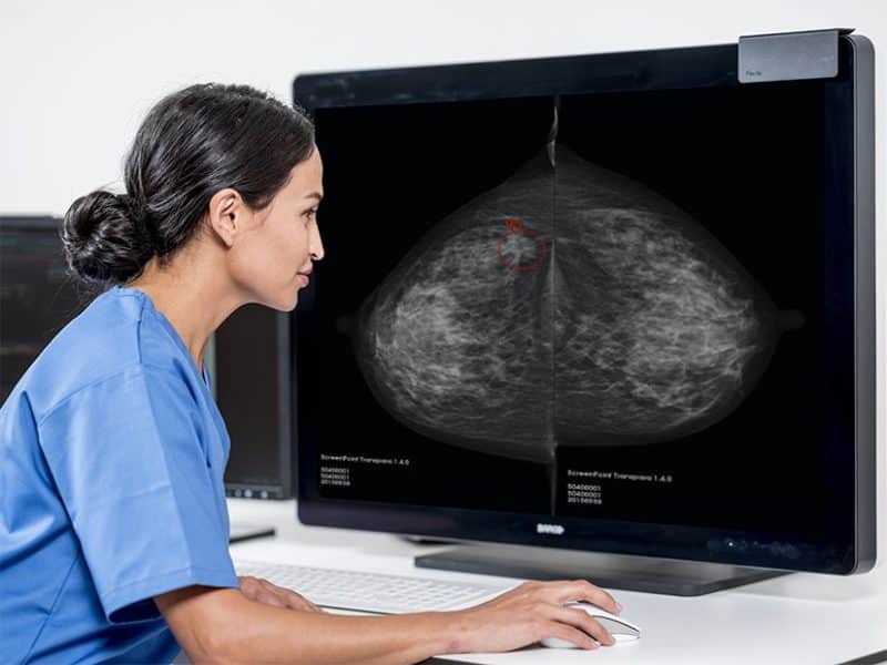 Breast Imaging - AGFA HealthCare